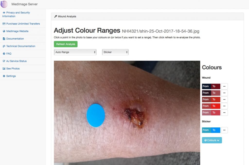 Addon – Wound Mapp – Guide – MedImage