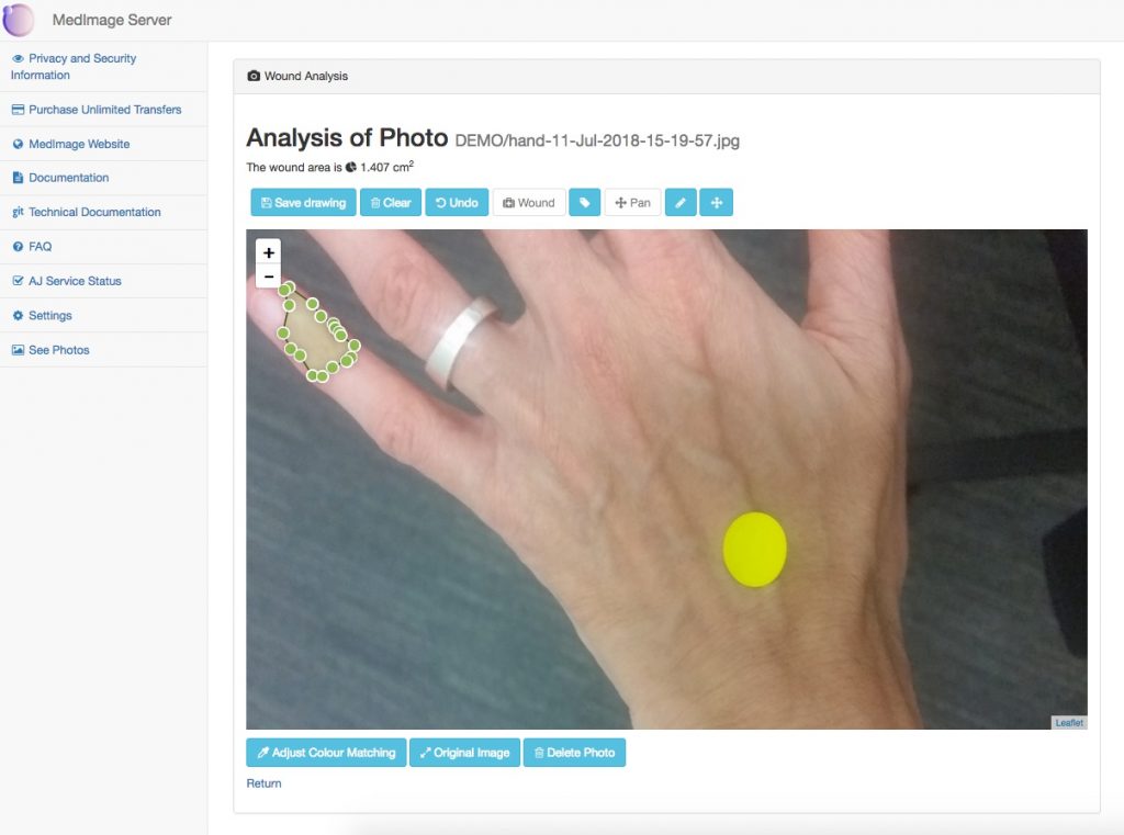 Addon – Wound Mapp – MedImage